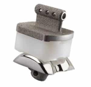 La prothèse de cheville pour traiter l'arthrose. - Dr Nicolas Pinar